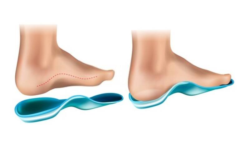 Arch Support and Why You Should Wear Them? - Hood MWR