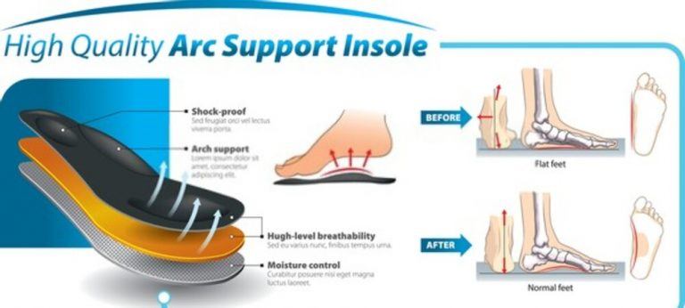 Arch Support and Why You Should Wear Them?
