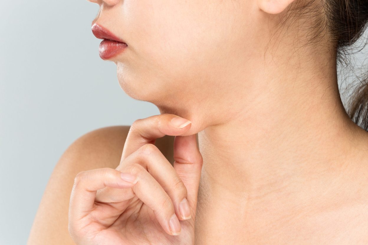 8 Effective Ways to Slim Chubby Cheeks (How to Lose Face Fat)
