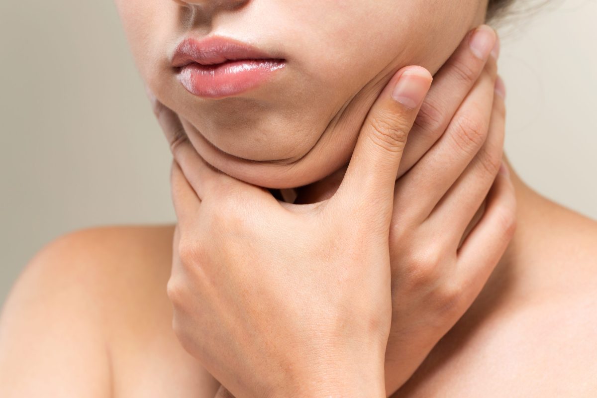 8 Effective Ways to Slim Chubby Cheeks (How to Lose Face Fat)