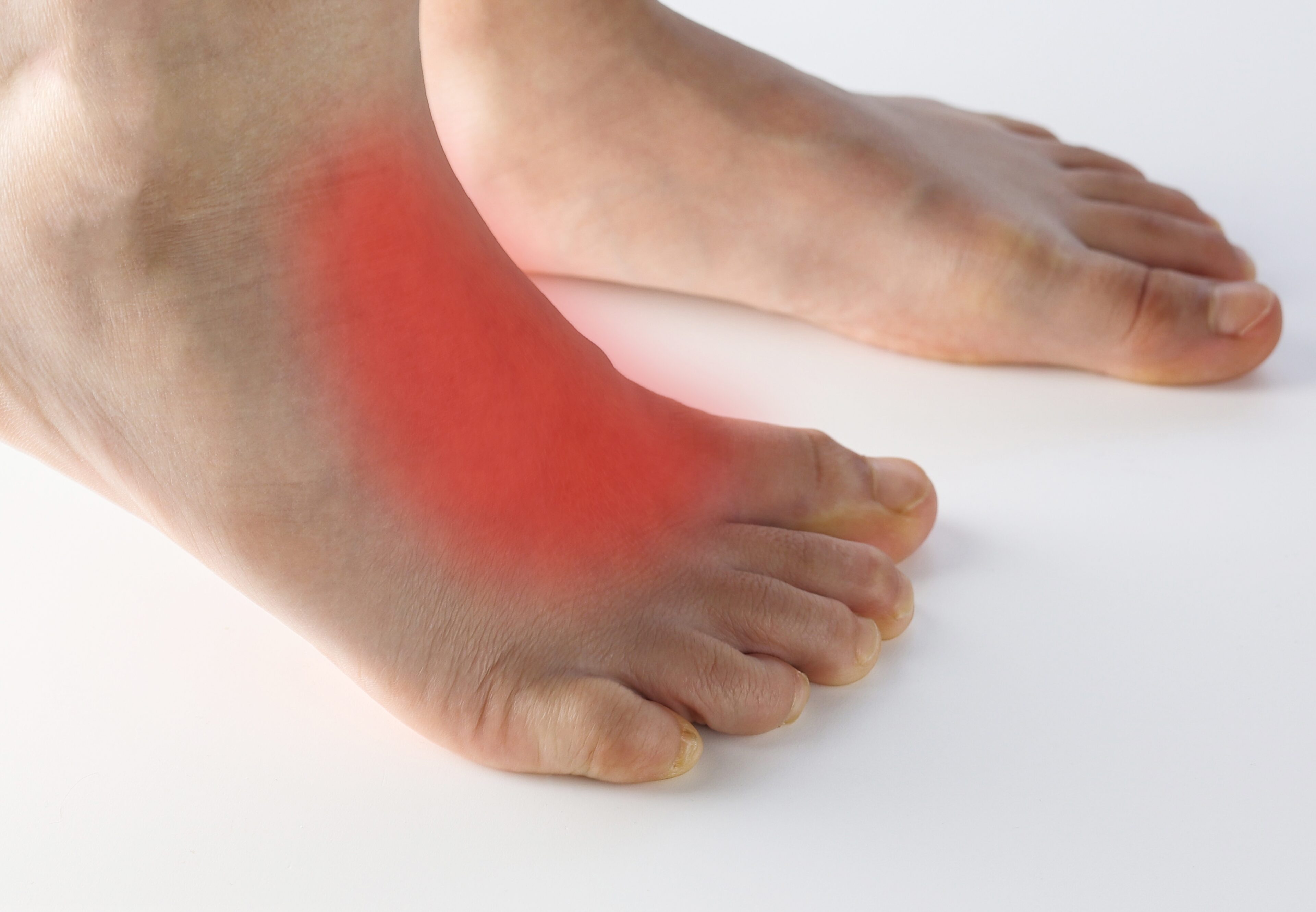 Top of Foot Pain While Walking: Causes and Treatment - Hood MWR