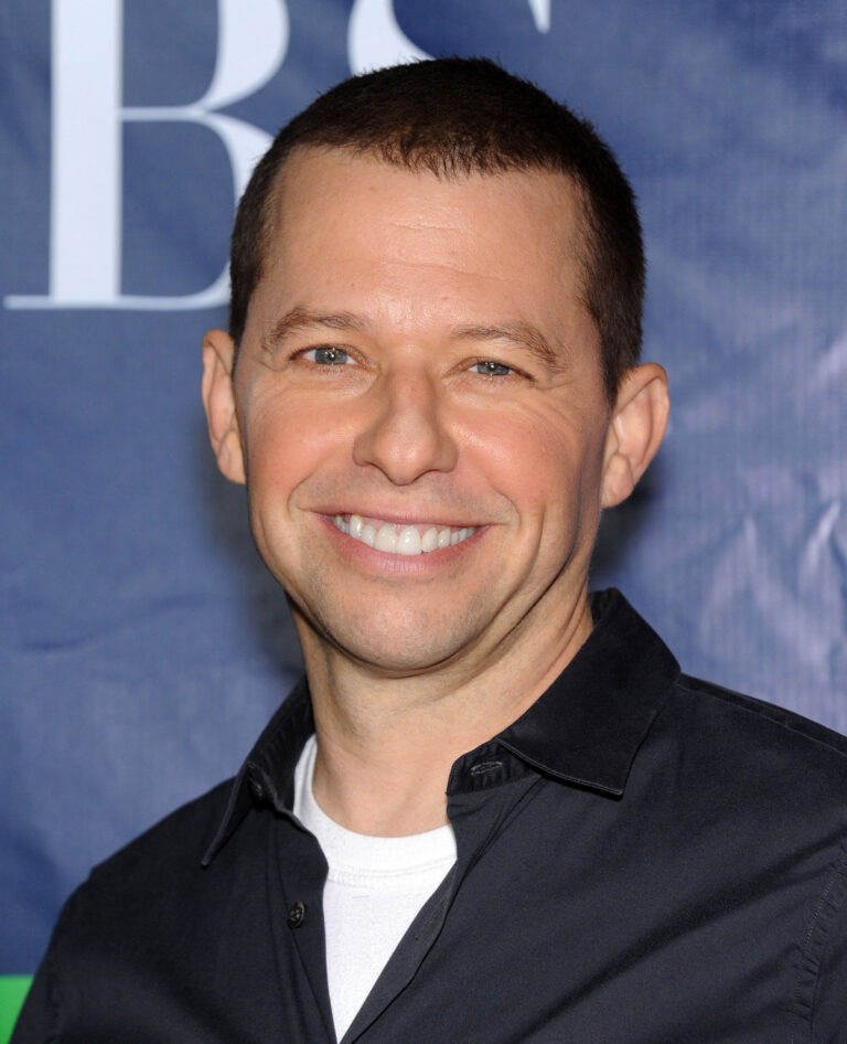 50 Celebrities Who Have Had Hair Transplants - Hood MWR