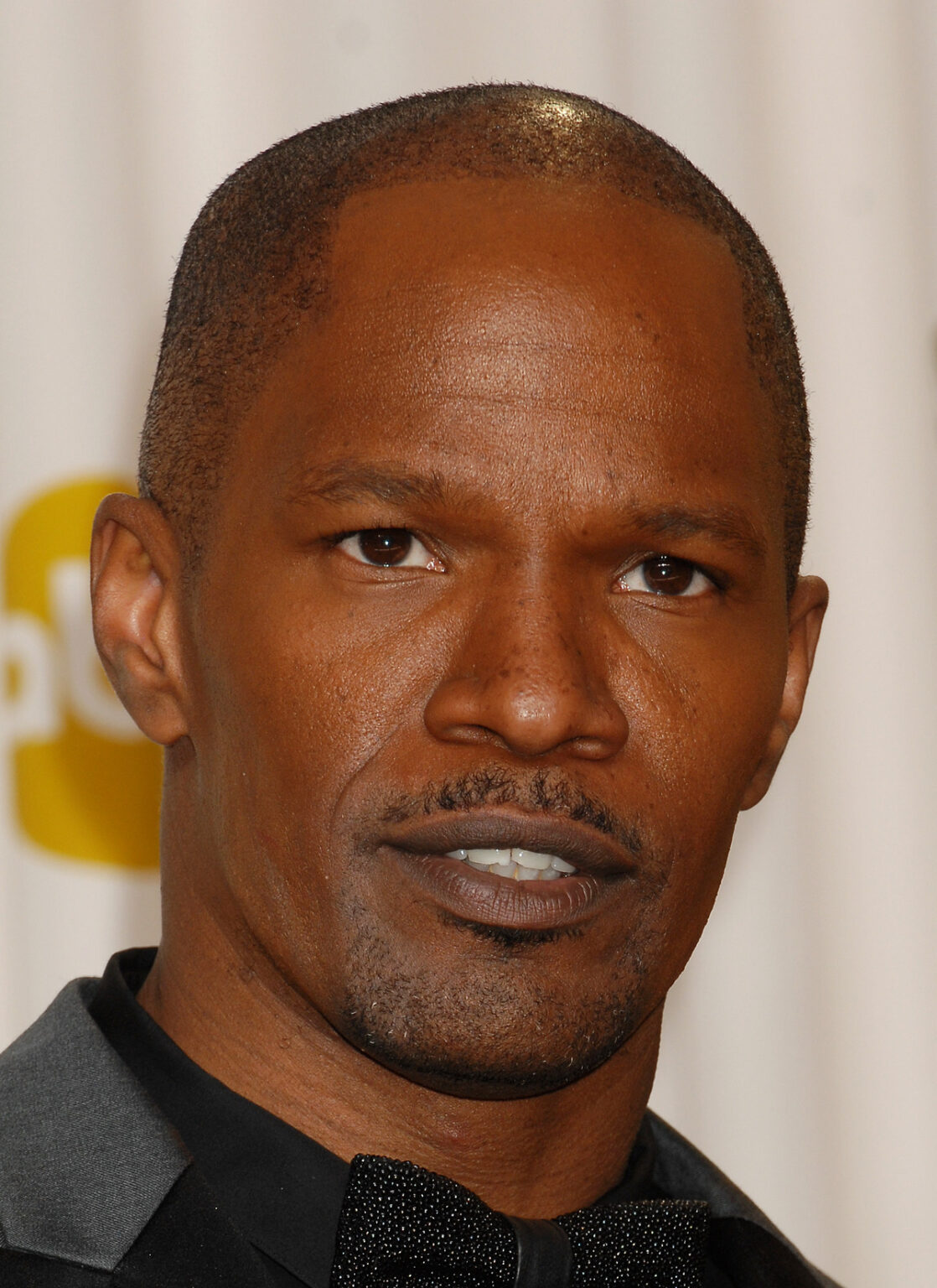 50 Celebrities Who Have Had Hair Transplants - Hood MWR