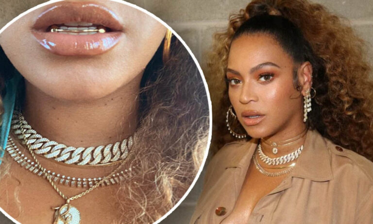 50 Famous People Decorate Their Teeth With Gems - Hood MWR