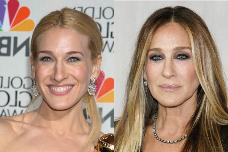 50 Celebrities Who Have Gotten a Thread Lift - Hood MWR