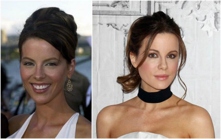 50 Celebrities Who Have Gotten a Thread Lift - Hood MWR