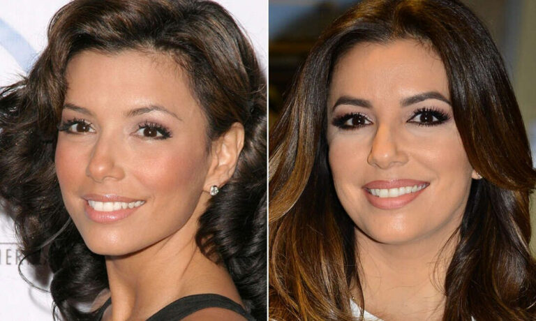 50 Celebrities Who Have Gotten a Thread Lift - Hood MWR