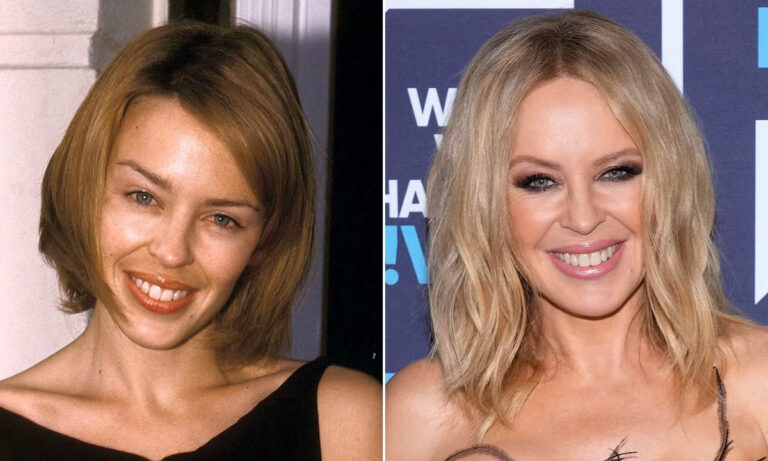 50 Celebrities Who Have Gotten a Thread Lift - Hood MWR