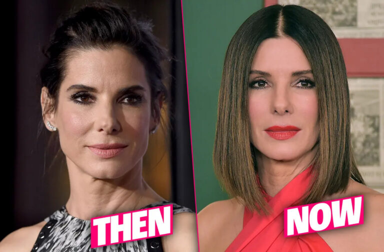 50 Celebrities Who Have Gotten a Thread Lift - Hood MWR