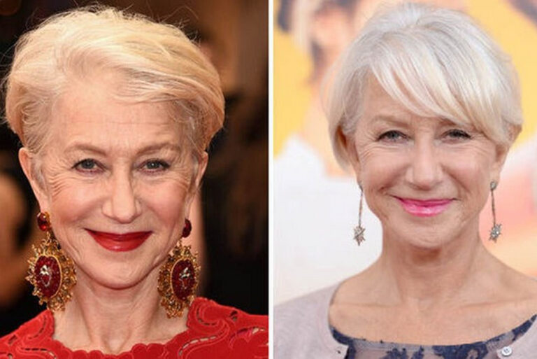 50 Celebrities Who Have Gotten a Thread Lift - Hood MWR