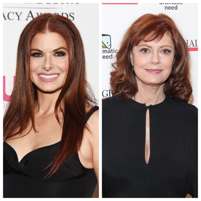 50 Celebrities Who Have Gotten a Thread Lift - Hood MWR