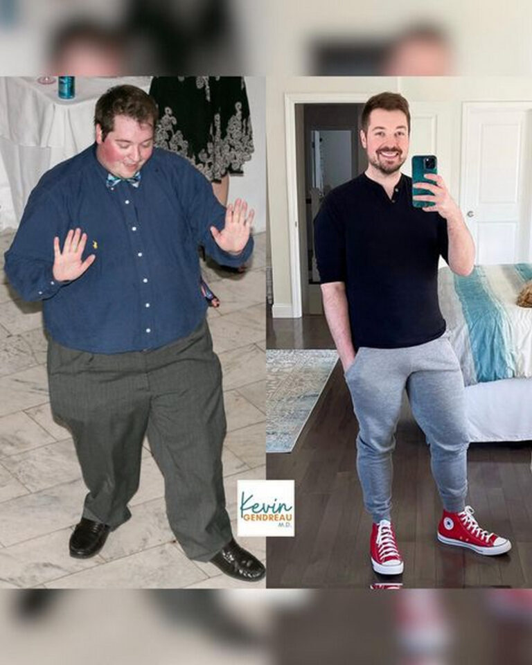 Top 30 Weight Loss Success Stories That Will Make You Believe Anything ...
