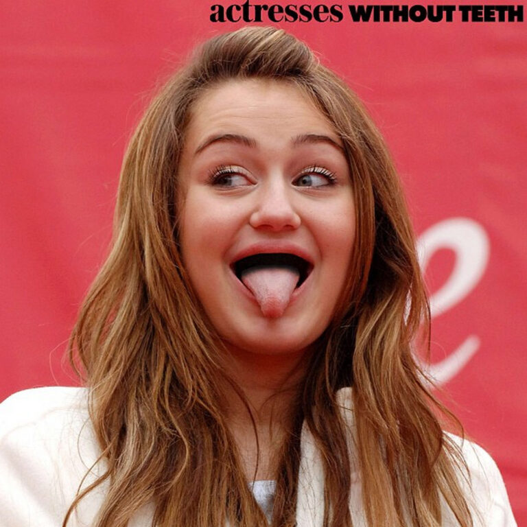 30 Famous No Teeth Celebrities Pictures - Hood MWR