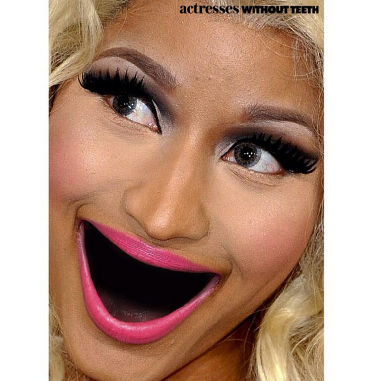 30 Famous No Teeth Celebrities Pictures