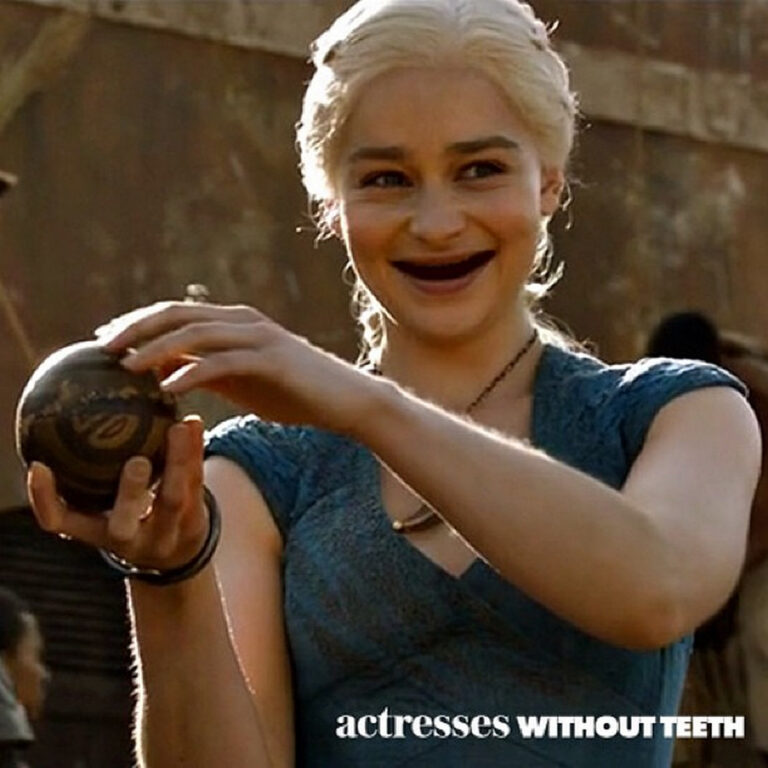 30 Famous No Teeth Celebrities Pictures - Hood MWR