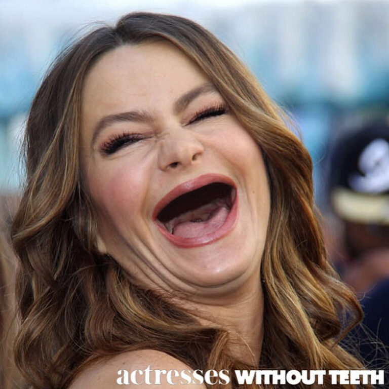 30 Famous No Teeth Celebrities Pictures - Hood MWR