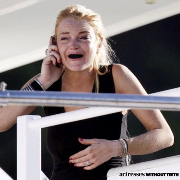 30 Famous No Teeth Celebrities Pictures - Hood MWR