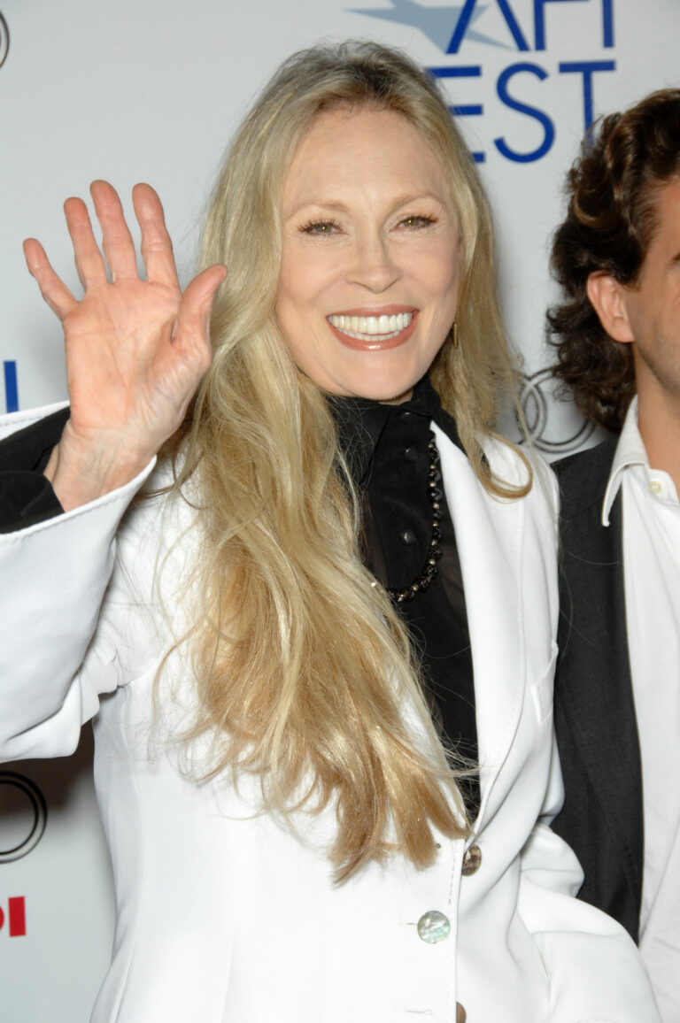 50 Celebrities With Veneers: A Look At Their Sparkling Smiles - Hood MWR
