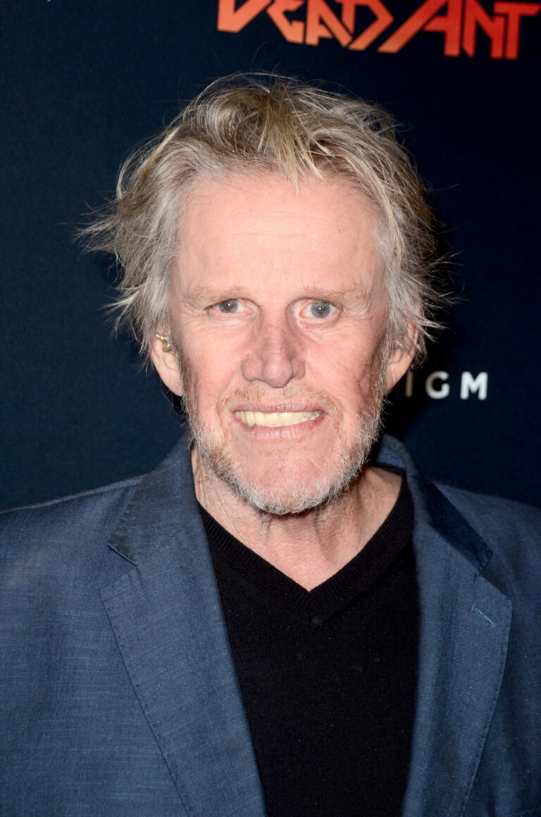36 Beautiful and Famous Celebrities With Full Dentures - Hood MWR