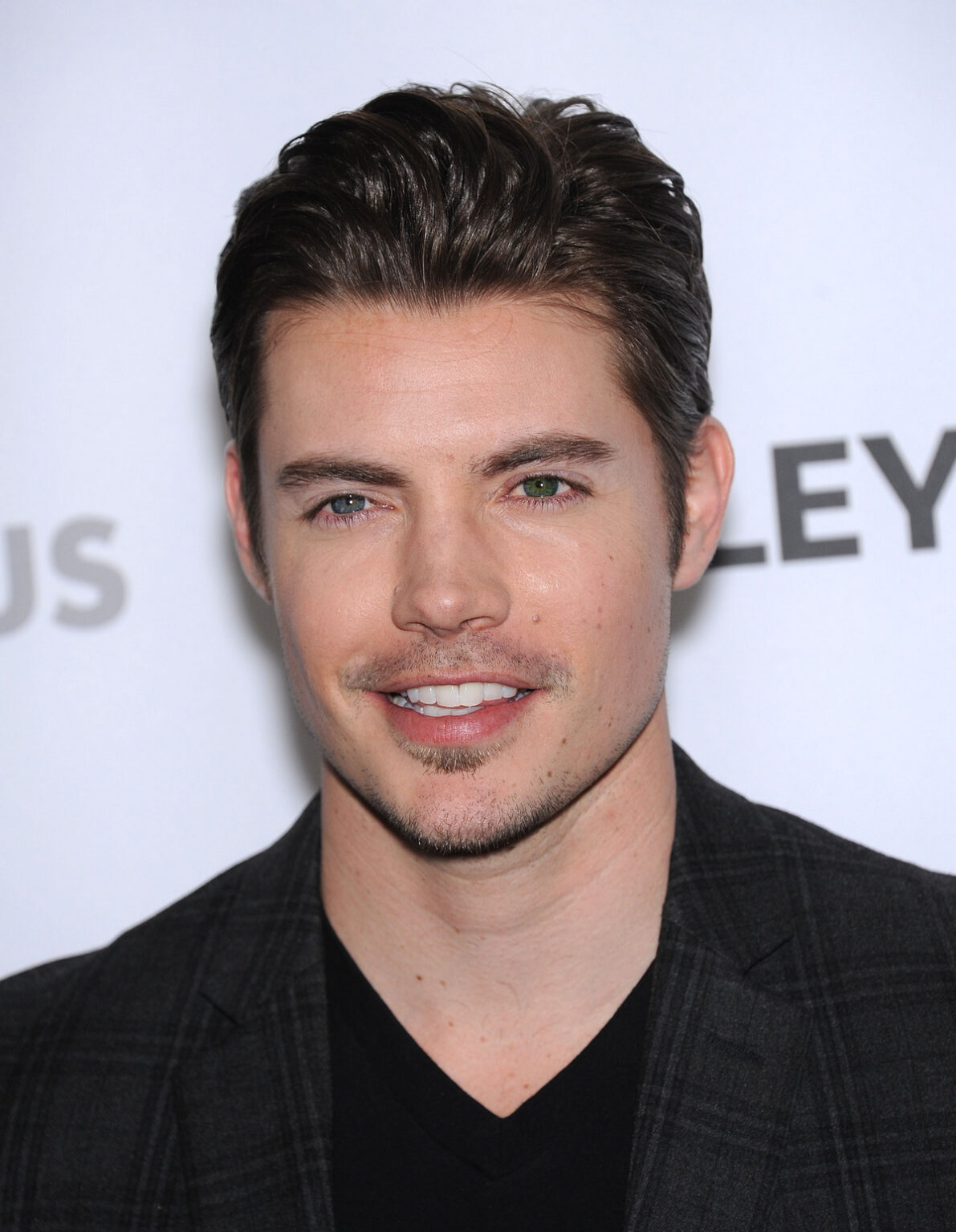 56 Celebrities With Beauty Mark (Moles) - Hood MWR