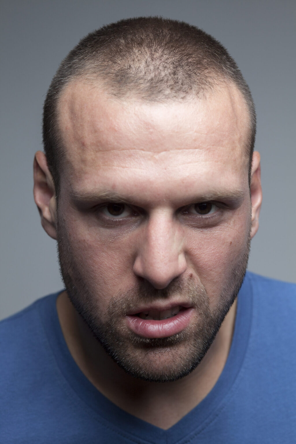 35 Hairstyles for Balding Men Embracing Their New Look - Hood MWR