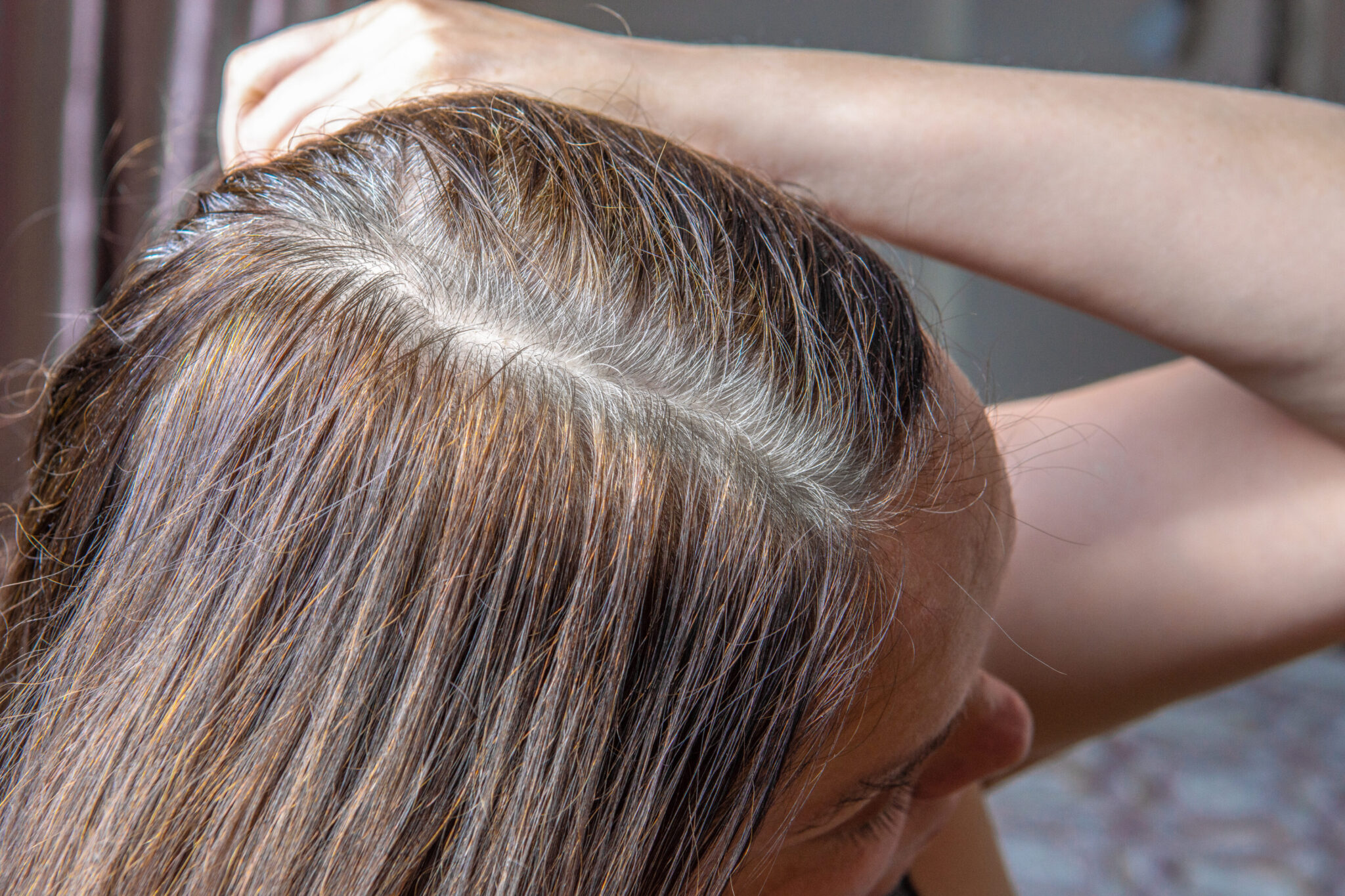 How to Fix Hot Roots? Causes and Solutions to Achieve Perfect Hair ...