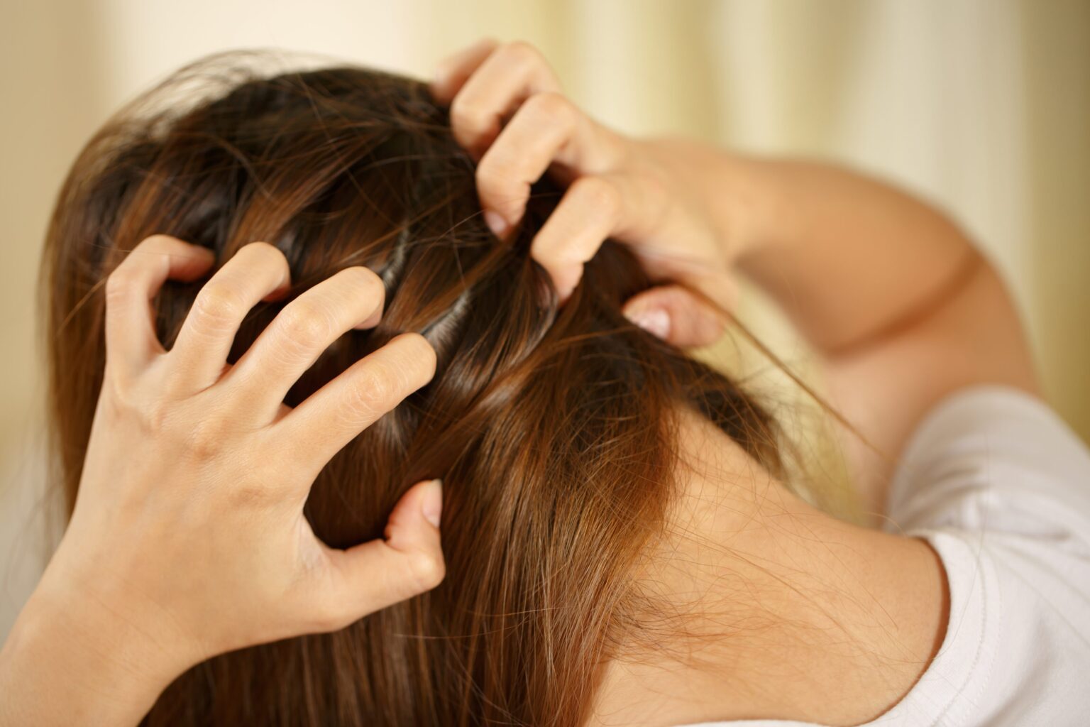 How To Treat And Heal Scabs On Scalp From Bleach? Gentle Care Guide