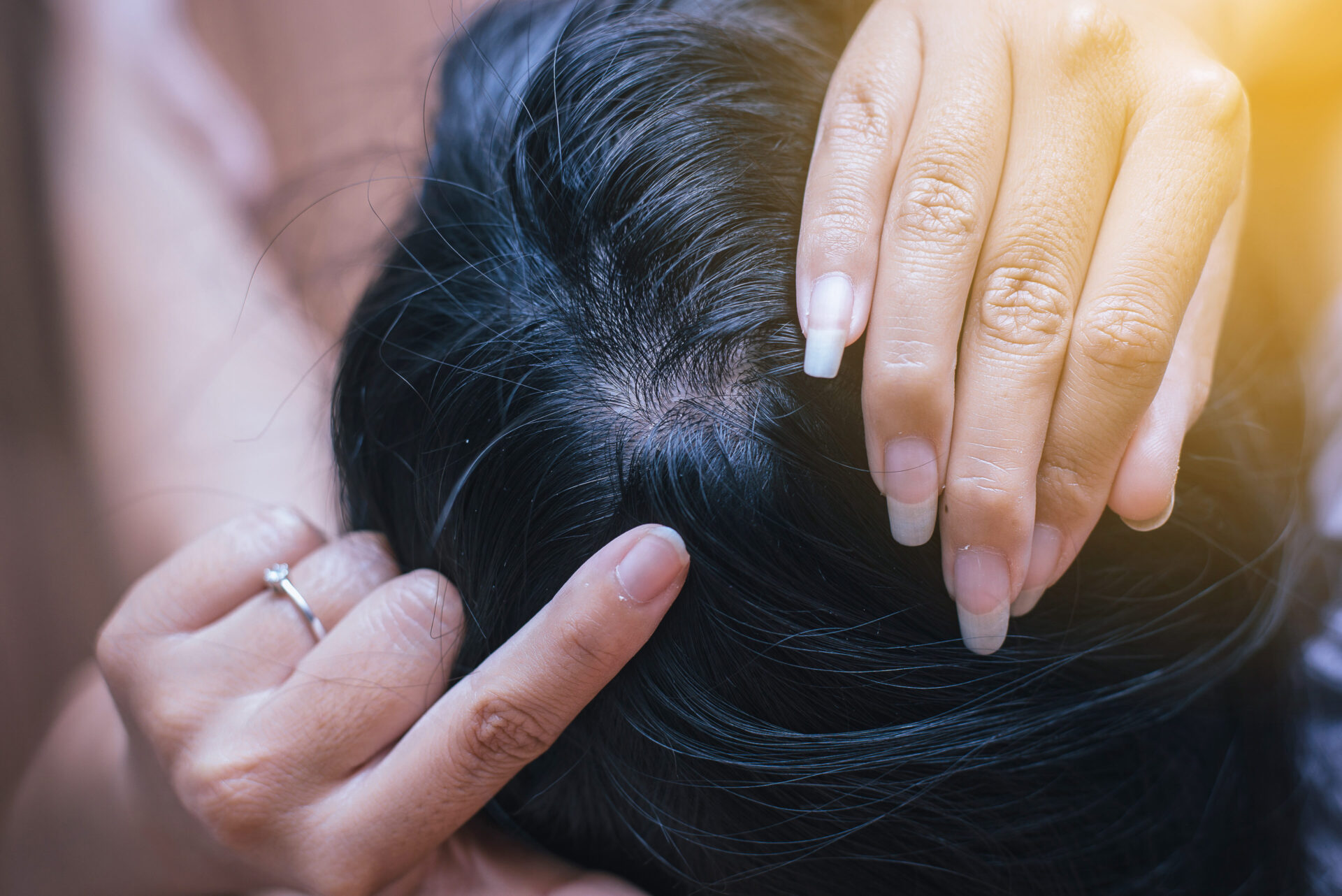 Hair Breakage On Top Of Your Head - Hood MWR