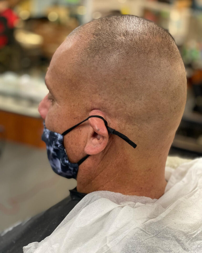 50 Haircuts For Balding Crown: Feel Confident With Styles - Hood MWR