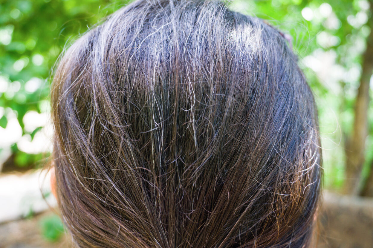 Hair Breakage On Top Of Your Head - Hood MWR